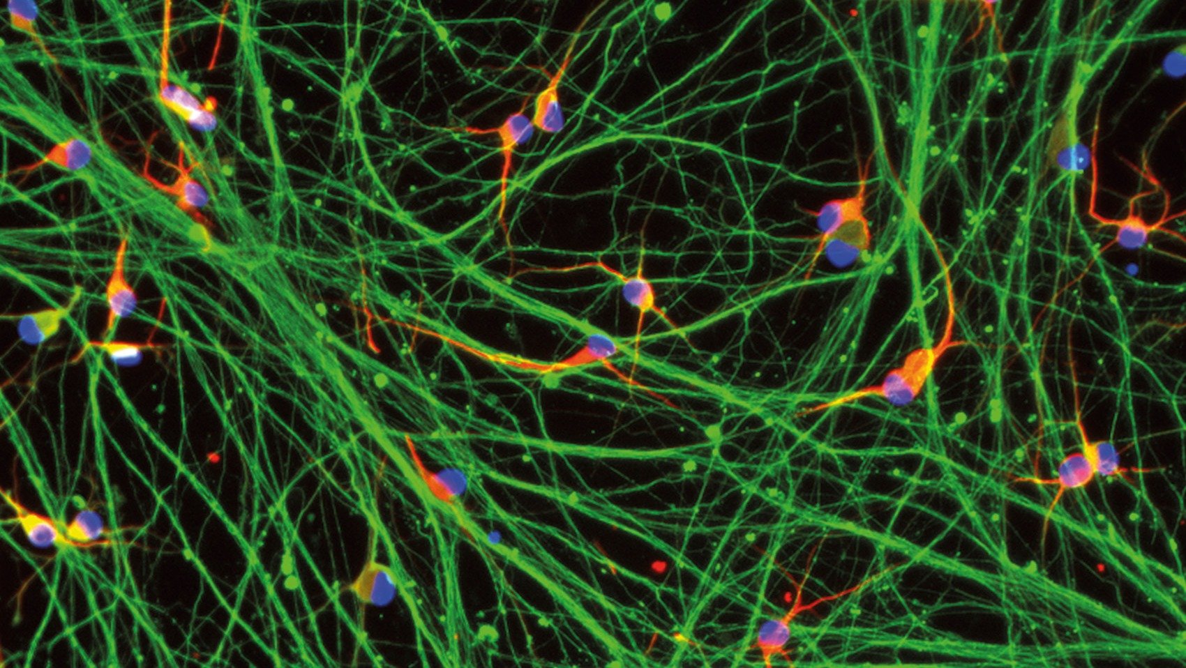 Modelling Huntington's with iPSC-derived Neurons | ioCells | bit.bio